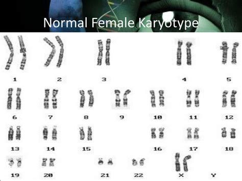 Ppt Karyotyping Lab Info Powerpoint Presentation Free Download Id