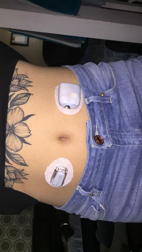 Just Got My Dexcom G5 Today Feeling More And More Like A Robot Using It With My Omnipod Any