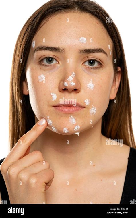 Woman Applying Acne Cream On Her Face For Solving Acne Inflammation On Her Face On A White