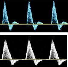 Waveforms Flashcards Quizlet