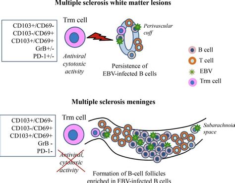 Tissue Resident Memory T Cells In The Multiple Sclerosis Brain And Their Relationship To Epstein