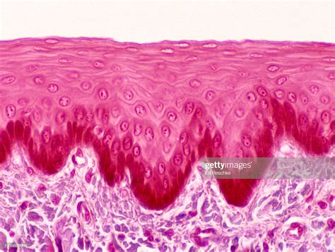 Stratified Squamous Epithelium Nonkeratinized Esophagus