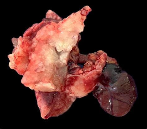 V N P Anatomopathological Findings And Identification Of Cryptococcus Gattii In