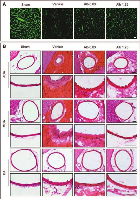 Capillary Perfusion And Main Cerebral Arterial Morphology A