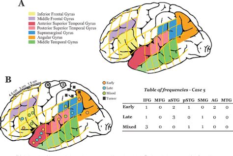 Figure 2 From Age Of Language Acquisition And Cortical Language Organization In Multilingual