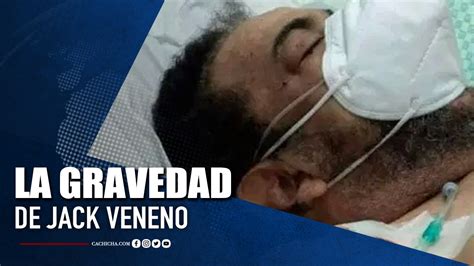 El Dr Cruz Jiminián habla sobre la gravedad de Jack Veneno Tu Tarde