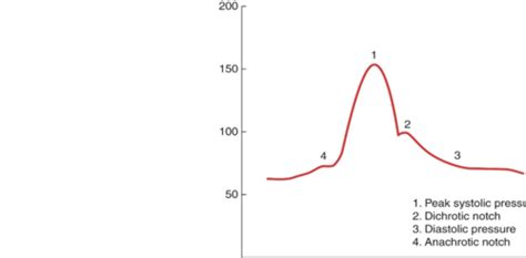 Hemodynamic Monitoring Flashcards Quizlet