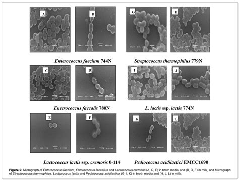 Microbial Biochemical Technology Enterococcus Faecium