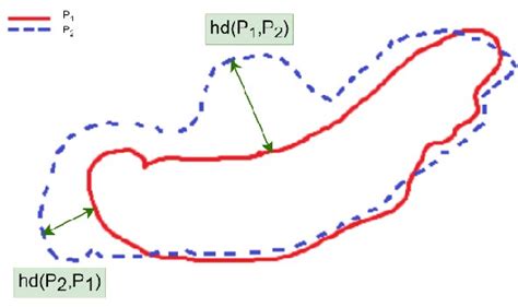 Figure 7 From A Novel Deep Learning Model For Pancreas Segmentation