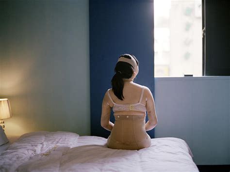 Intimate Post Op Portraits Of Plastic Surgery Patients Nsfw Co Design Business Design