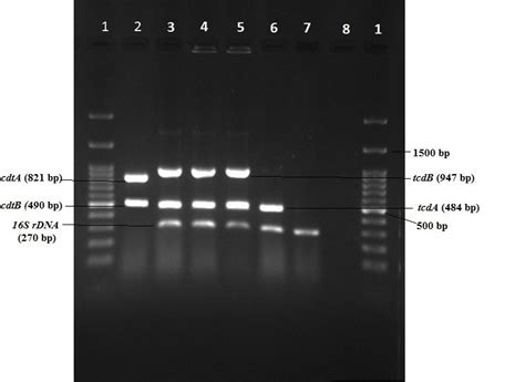 Gel Electrophoresis Of 16s Rdna Toxin A B And Cdt Genes The Pcr