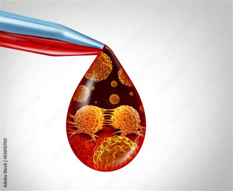 Cancer Screening And Blood Test For Early Detection Of Malignant Cells In A Human Body Caused By