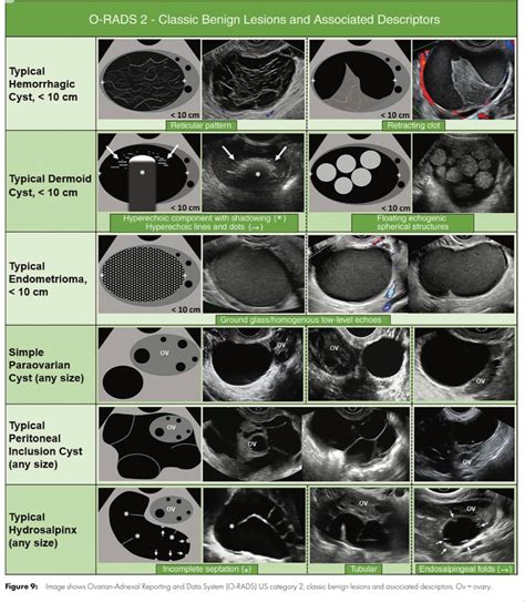 Vascular Ultrasound Ultrasound Sonography Obstetric Ultrasound Mri