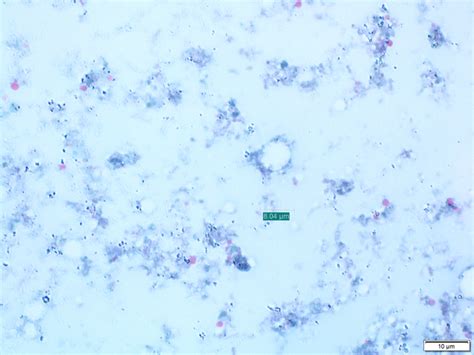 Blastocystis Cyst Black Arrow In Stool Sample Stained With Trichrome