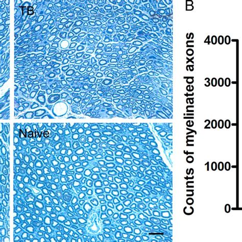 The Tibial Nerve Distal To Injection Site Exhibits An Equal Number Of Download Scientific