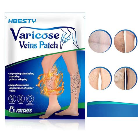 Пластырь от варикоза тромбоза и васкулита Varicose Veins Patch 8 шт