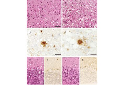 Histology And Immunohistochemistry Ihc Of Prp Sc In The Brains Of Download Scientific Diagram