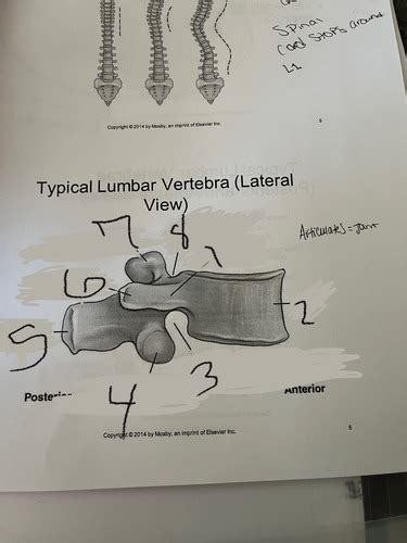 Lumbar Spine Flashcards Quizlet