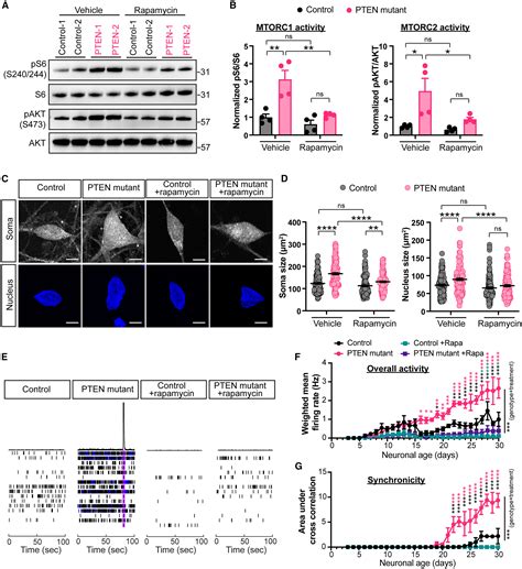 Synergistic Hyperactivation Of Both Mtorc1 And Mtorc2 Underlies The