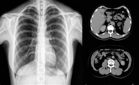 Can A Pregnant Woman Do An X Ray Trena Mccombs