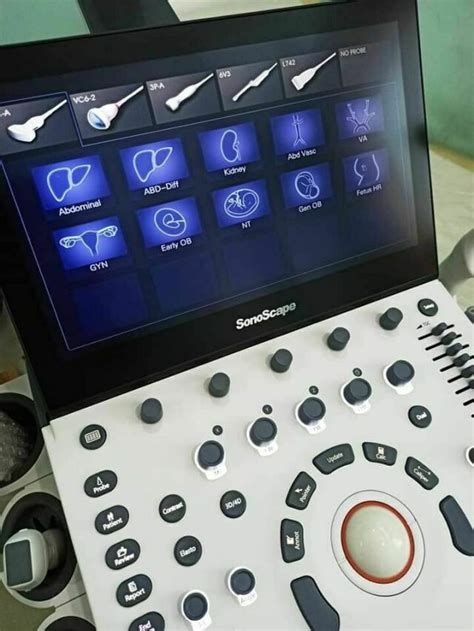 New Sonoscape P15 Trolley Color Doppler System Ob Gyn Ultrasound For