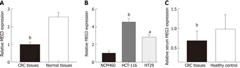 Long Non Coding Rna Meg3 In Tissue Serum And Cell Lines A Relative Download Scientific