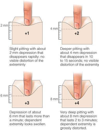 Physical Assessment Flashcards Quizlet