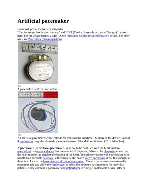 pdf artificial pacemaker docshare01 docshare tipsdocshare01