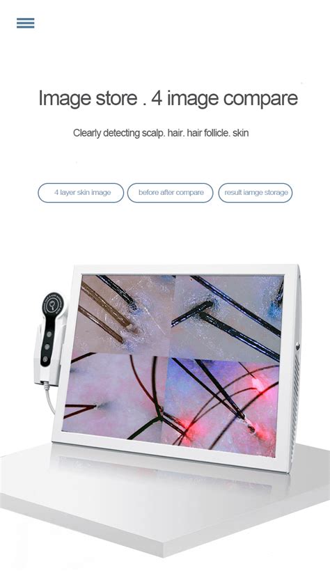 Skin And Scalp Analyzer Different Version With Or Without Report