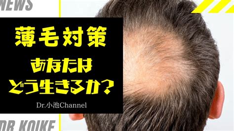 【医師解説】薄毛は遺伝ではない！？50の確率でハゲる！？ハゲと遺伝の本当の関係について公開 Youtube