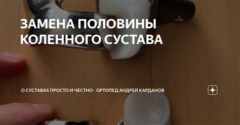 ЗАМЕНА ПОЛОВИНЫ КОЛЕННОГО СУСТАВА О СУСТАВАХ ПРОСТО И ЧЕСТНО