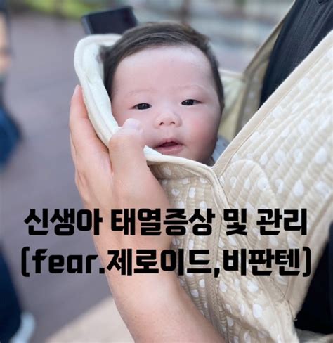 신생아 태열 증상 및 관리 Feat 제로이드로션 비판텐 네이버 블로그