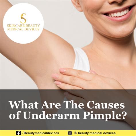 What Are The Causes Of Underarm Pimple