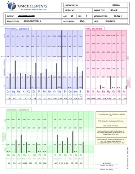 Hair Mineral Tissue Analysis Htma Chloe Jane Wellness