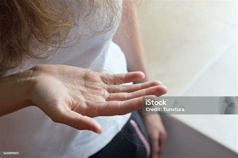 떨어진 머리카락을 잔뜩 들고 있는 여자 탈모 개념 또는 Trichotillomania 인간의 충동 행동 문제 머리카락 당김 장애