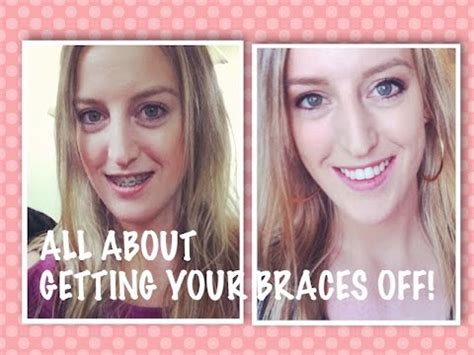 ALL ABOUT GETTING YOUR BRACES OFF Part 1 YouTube