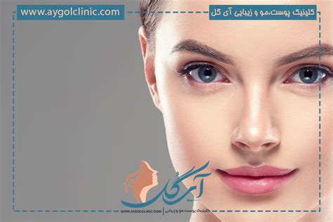 هر آن چیزی که باید در مورد بلفاروپلاستی چشم گربه ای بدانید آی گل