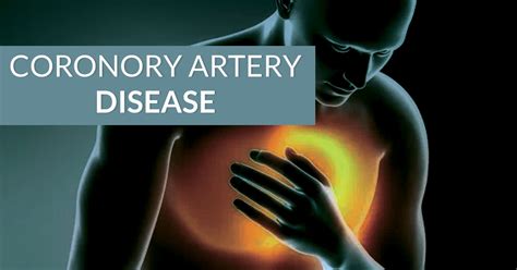 3 Treatment Approaches For Coronary Artery Disease Marham