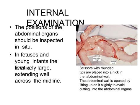 Fetalautopsy 1pptx