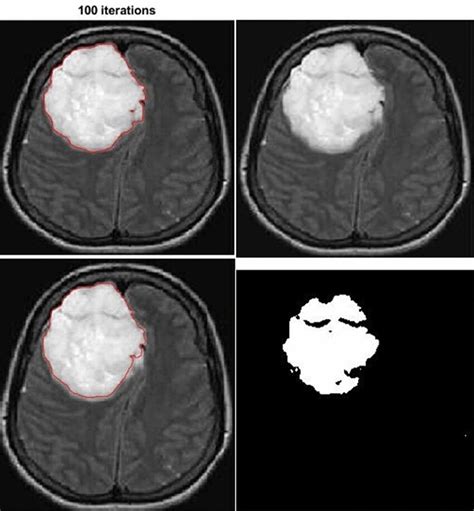Original Image Top Left The Result Of 100 Iteration Top Right The