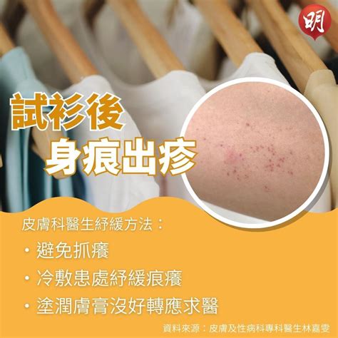 試衫後身痕出疹 皮膚科醫生：冷敷紓緩痕癢 塗潤膚膏沒好轉應求醫 0903 20230718 熱點 即時新聞 明報新聞網