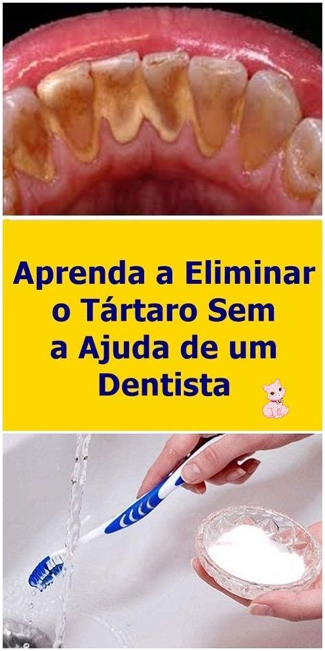 Apenas uma Aplicação Elimina Todos TÁRTARO dos Dentes e Clareia Alimentos veganos