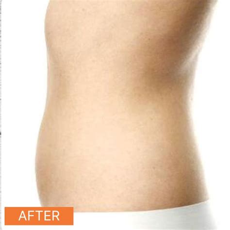 Ballancer Pro Lymphatic Drainage Sherman Oaks Ca