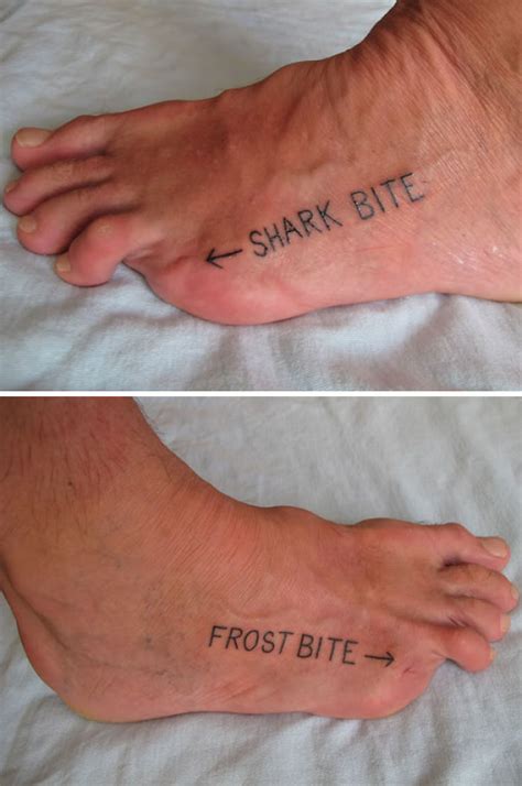 10 Hilarious Amputees Who Made The Best Jokes Out Of Their Situation Demilked