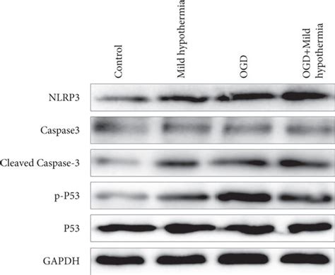 Mild Hypothermias Effect On Cell Apoptosis And The Inflammasome