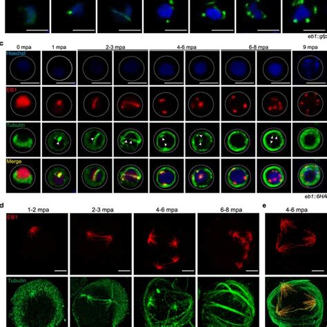 Plasmodium Eb1 Shows Mt Lattice Affinity A Protein Domain Organization