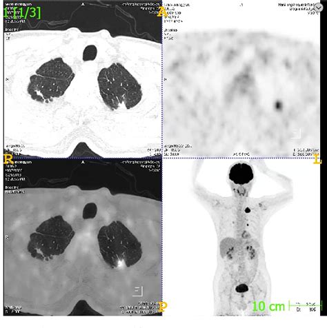 figure 1 from a deep learning based ct image analytics protocol to
