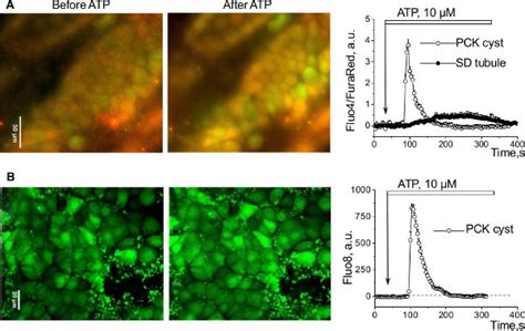 Effects Of Atp On Calcium Influx In The Cystic Cells Of The Pck Rats