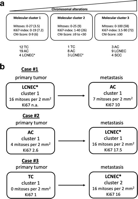 Thymic Tumors Classification At Charles Wagar Blog