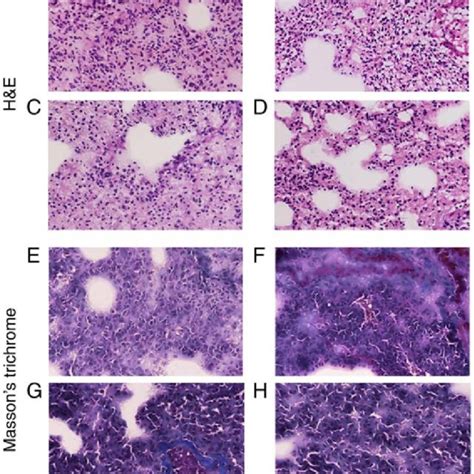 Hematoxylin And Eosin And Massons Trichrome Staining Of Lung Tissues A